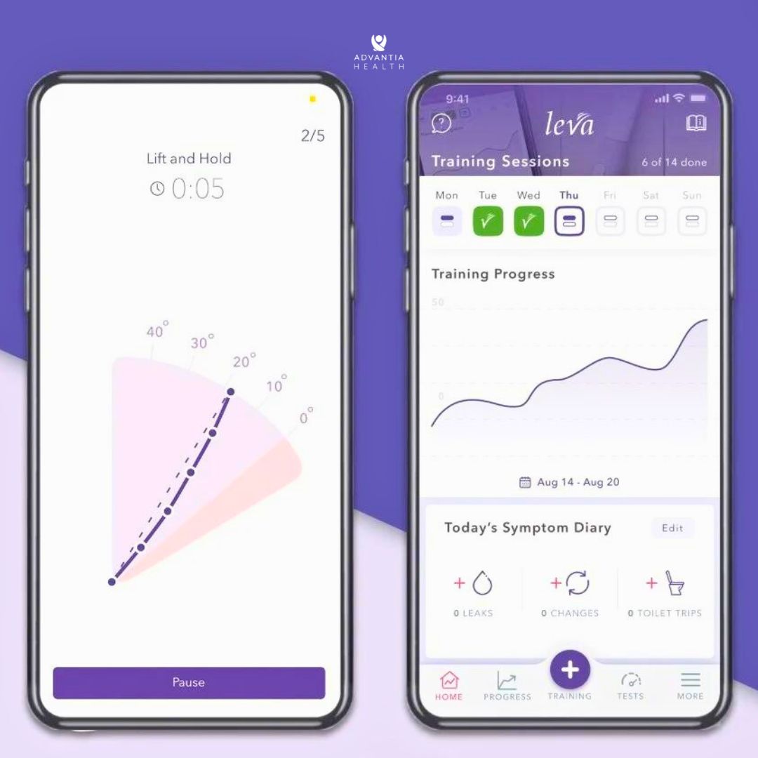 Leva® Pelvic Health System | Advantia Health